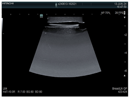 Liver Phantoms Cast in 3D-Printed Mold for Image-Guided Procedures