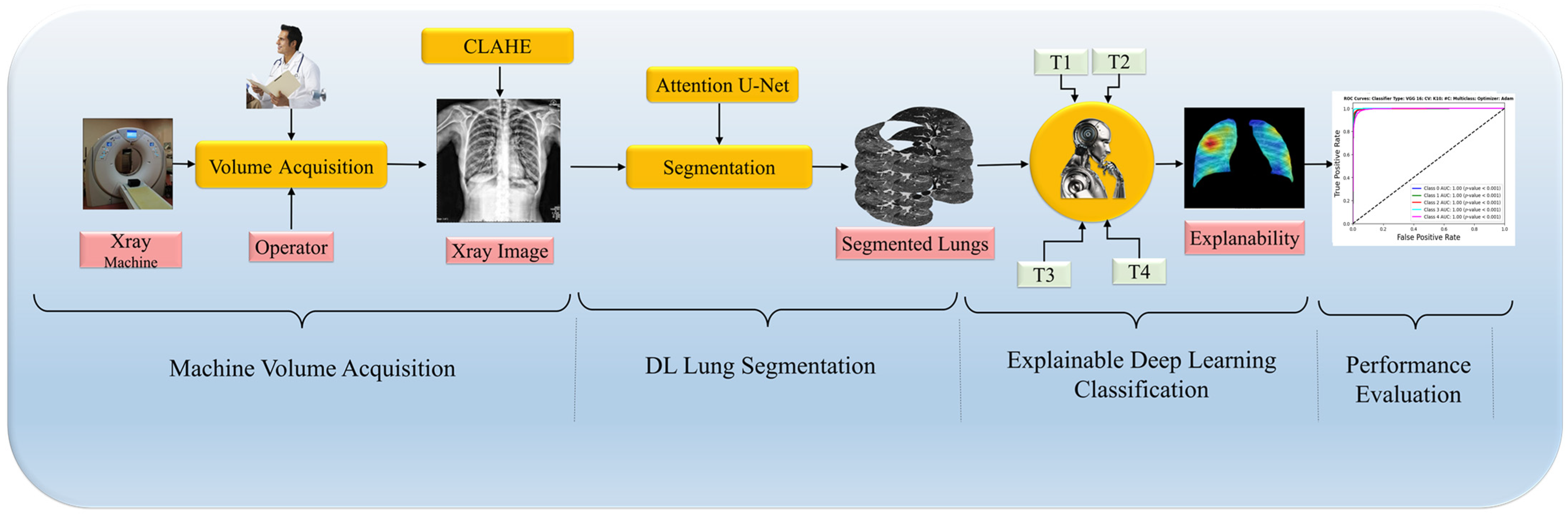 Four Transformer-Based Deep Learning Classifiers Embedded with an Attention U-Net-Based Lung ...