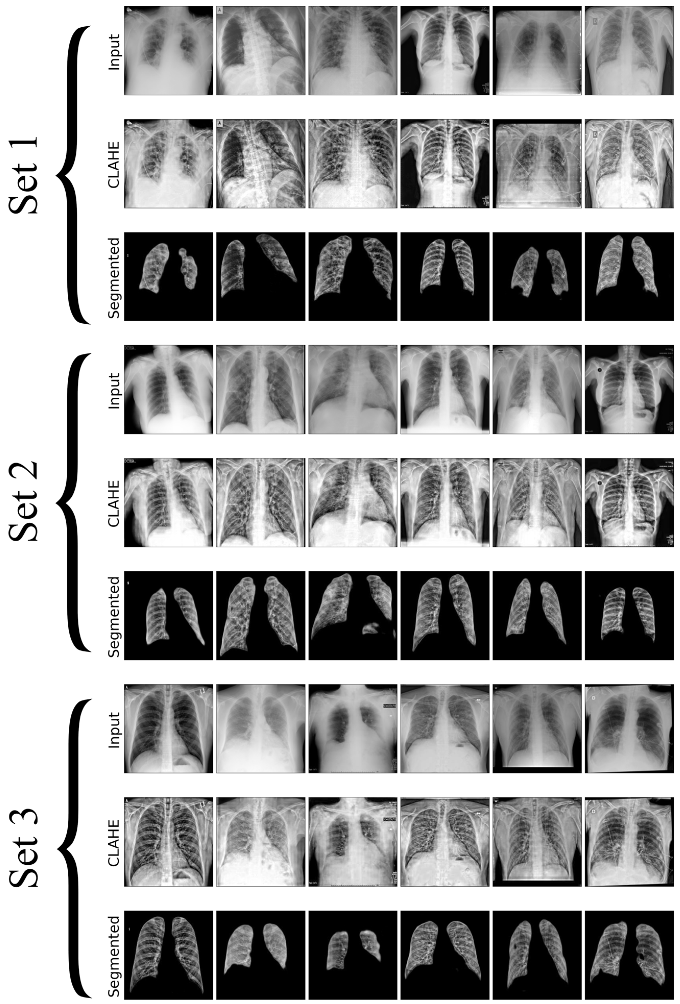 Four Transformer-Based Deep Learning Classifiers Embedded with an Attention U-Net-Based Lung ...