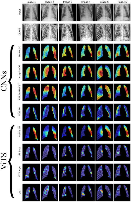 Four Transformer-Based Deep Learning Classifiers Embedded with an ...