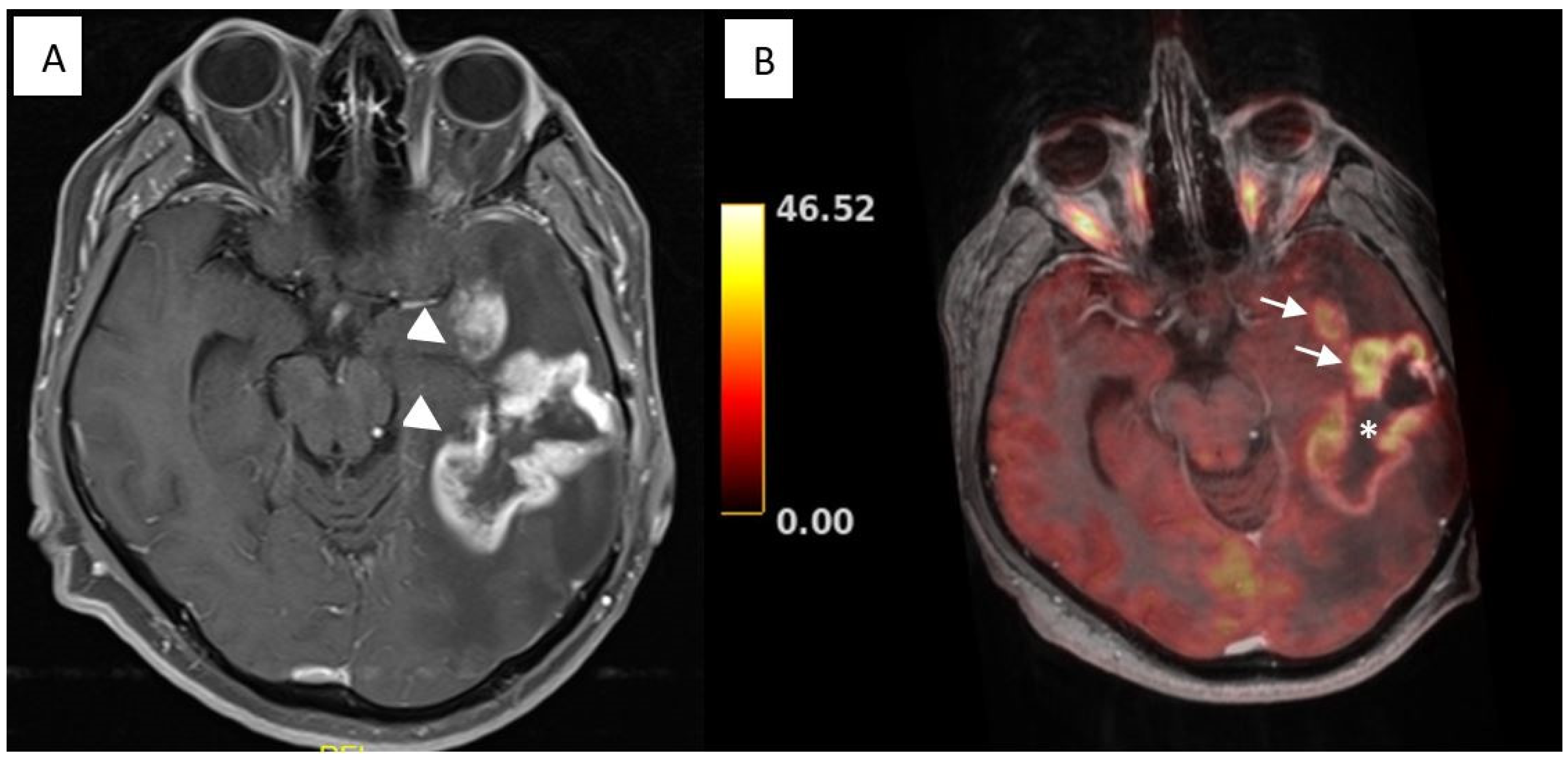 Hybrid Positron Emission Tomography and Magnetic Resonance Imaging ...