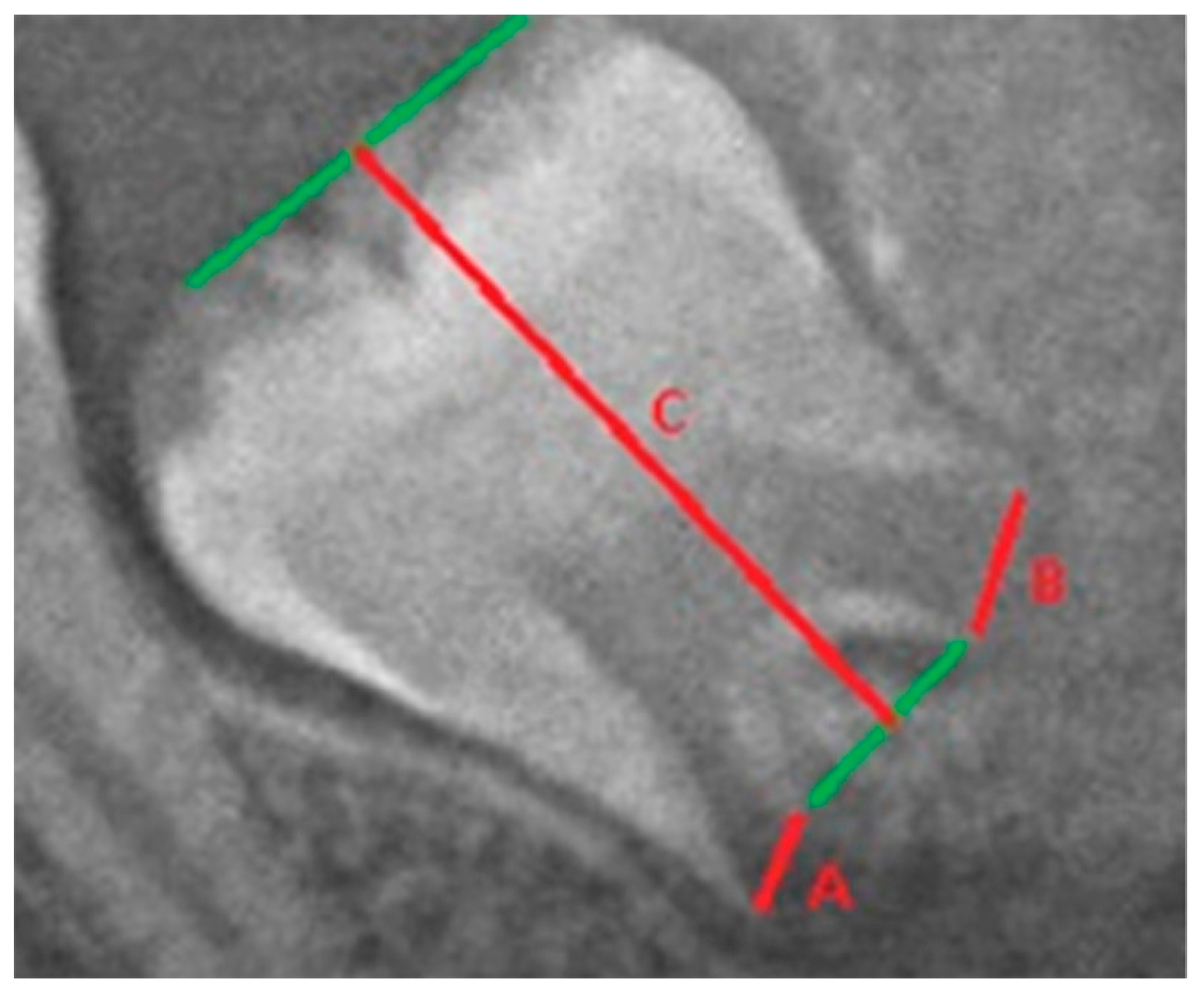 Diagnostics | Free Full-Text | Dental Age Assessment Based on ...
