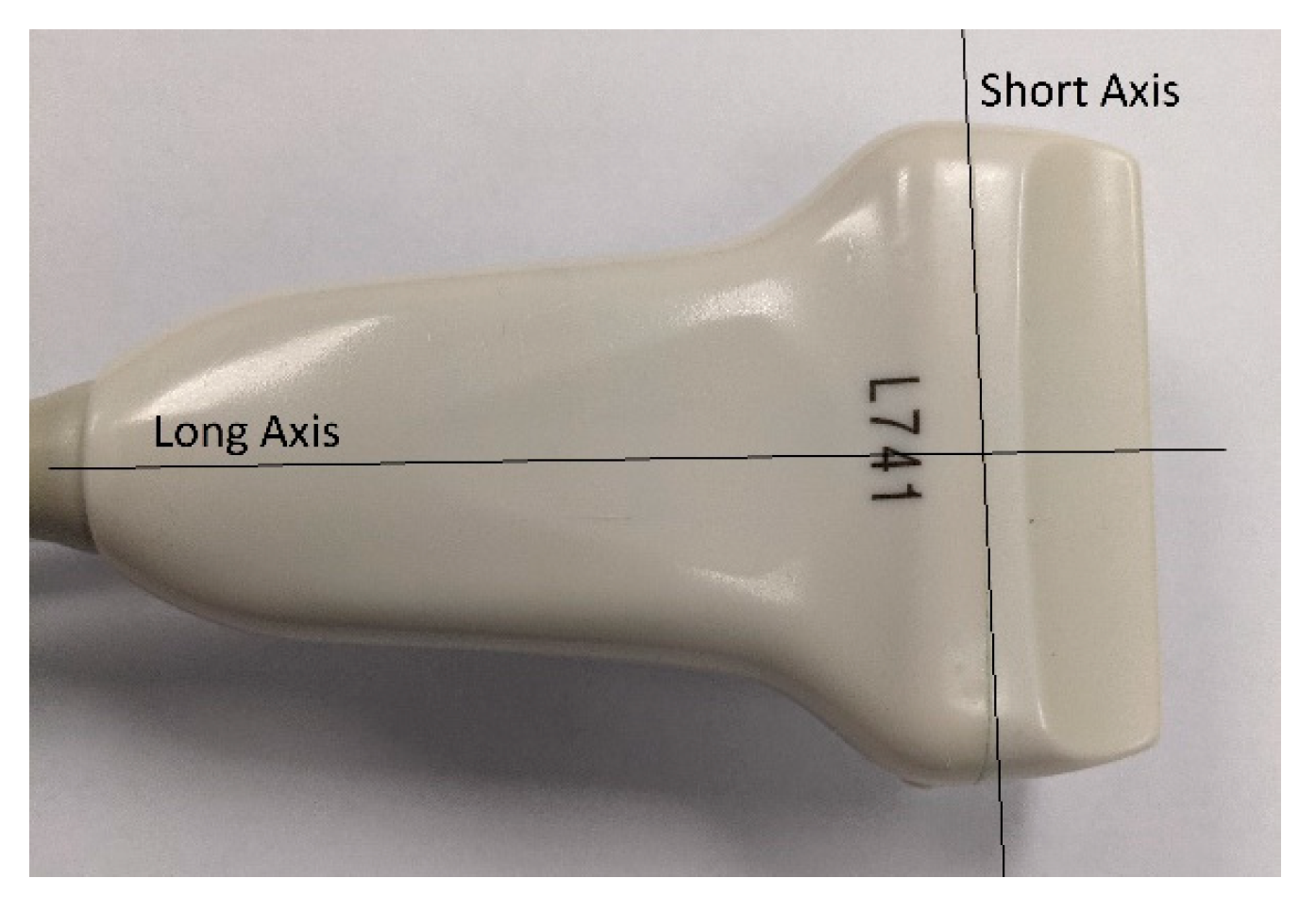 Improving Lesion Location Reproducibility in Handheld Breast Ultrasound