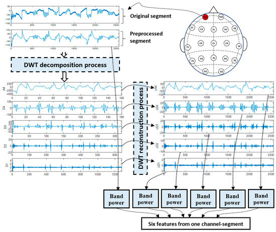 EEG-Based Detection of Mild Cognitive Impairment Using DWT-Based Features and Optimization Methods