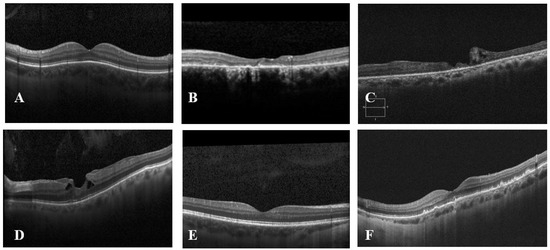 Exploring Publicly Accessible Optical Coherence Tomography Datasets: A ...
