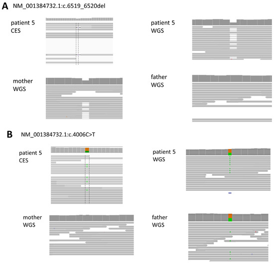 Diagnostic Yield of Trio Whole-Genome Sequencing in Children with ...