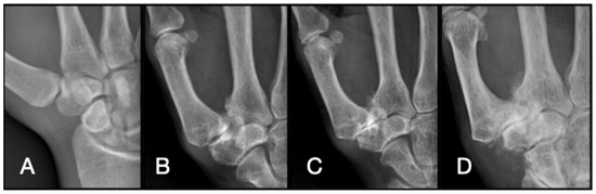 Assessing the Predictive Accuracy of the Eaton–Littler Classification ...