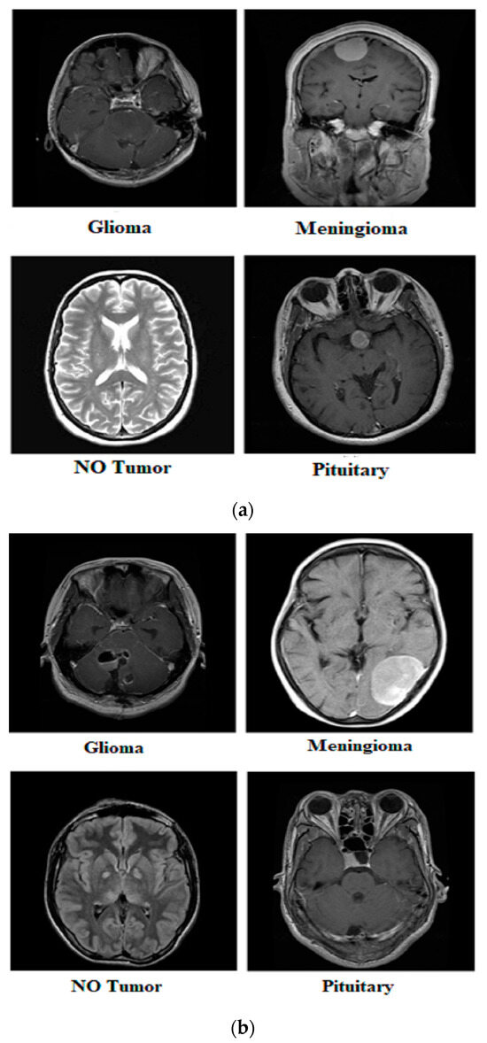 Brain Tumor Detection and Classification Using an Optimized ...