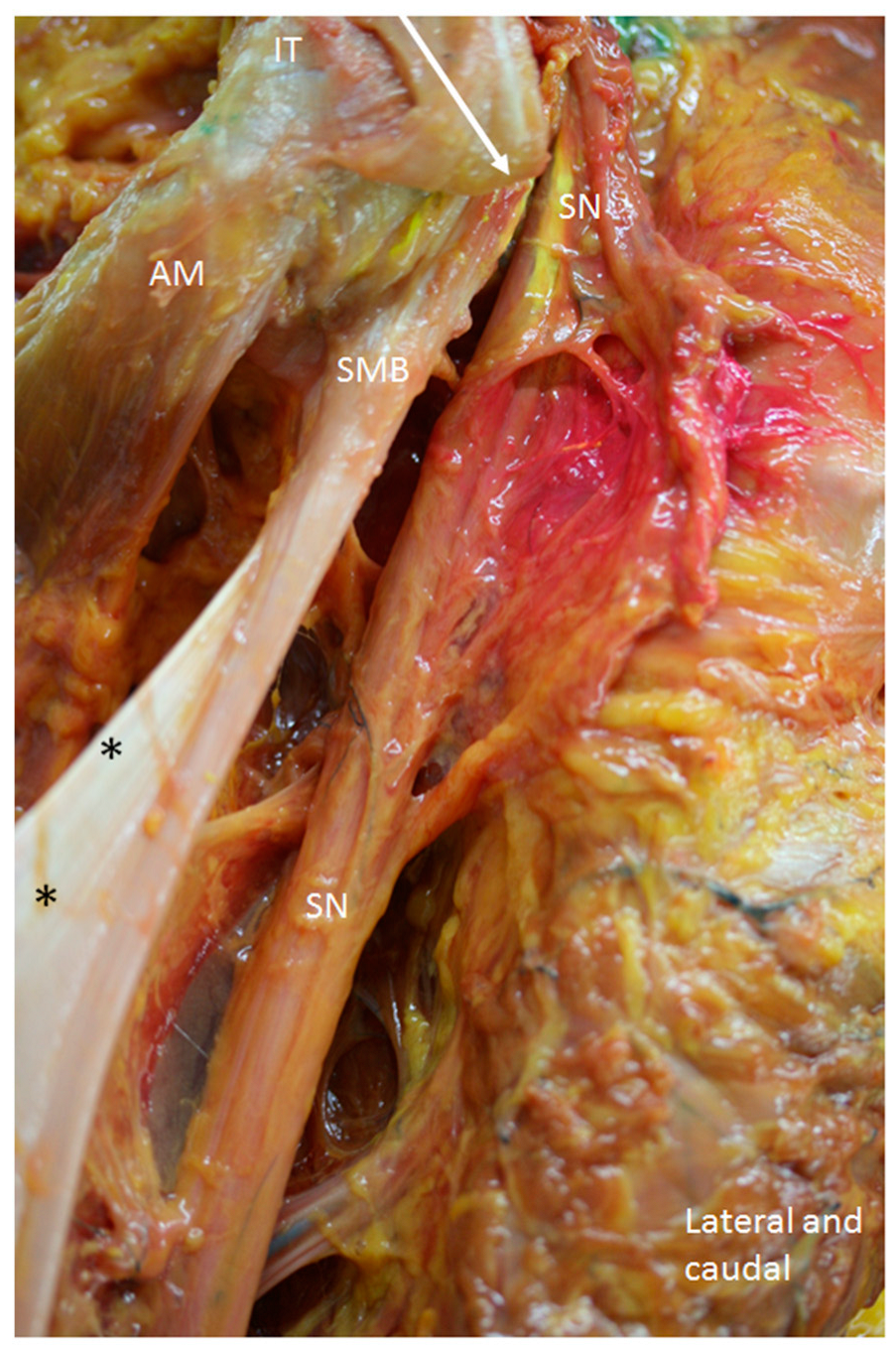 Anatomical Relationships of the Proximal Attachment of the Hamstring ...