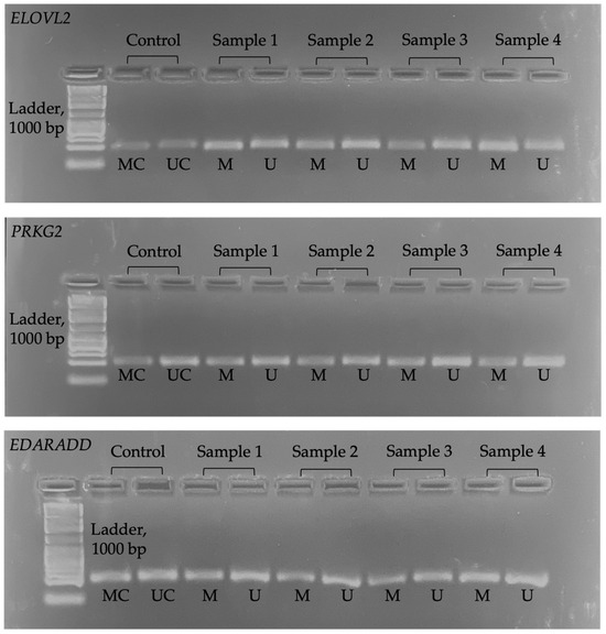 ELOVL2, PRKG2, and EDARADD DNA Methylation Strongly Estimate Indonesian ...