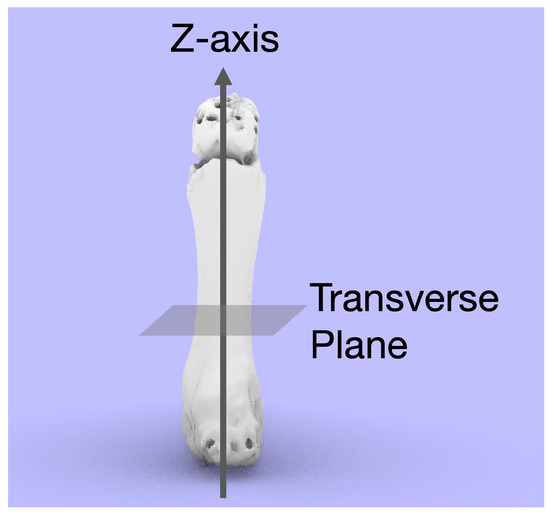 Quantitative Measurement of Rotation in Phalangeal Fracture Malunion ...