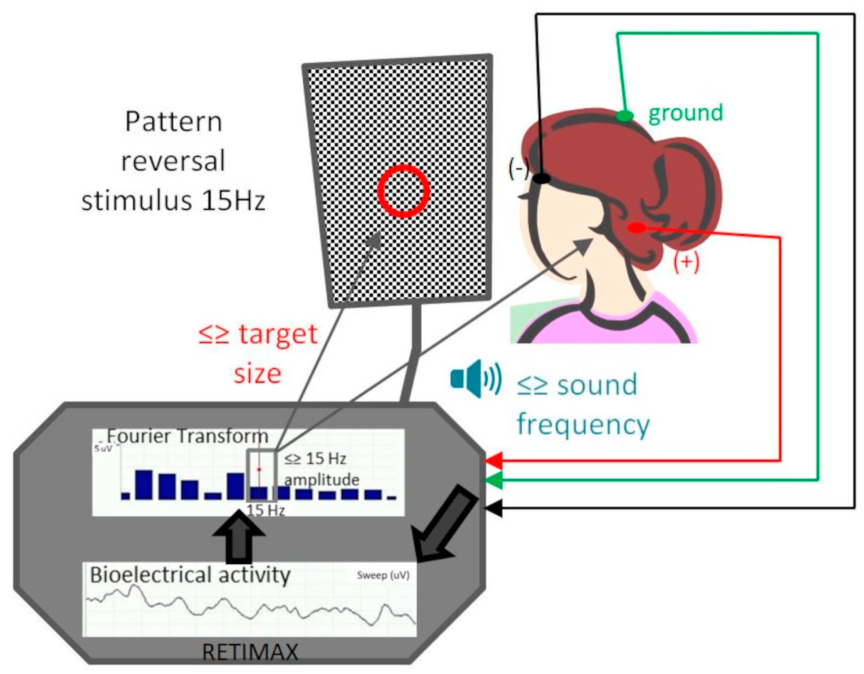 Reconnecting Anisometropic Amblyopic Eyes to the Cortex: VEP-Based Auditory Biofeedback