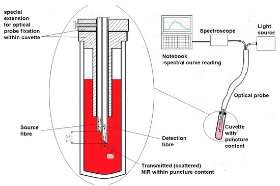 Diagnostics | Free Full-Text | Near-Infrared On-Site Evaluation (NOSE ...