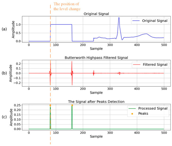 Paper-Recorded ECG Digitization Method with Automatic Reference Voltage ...