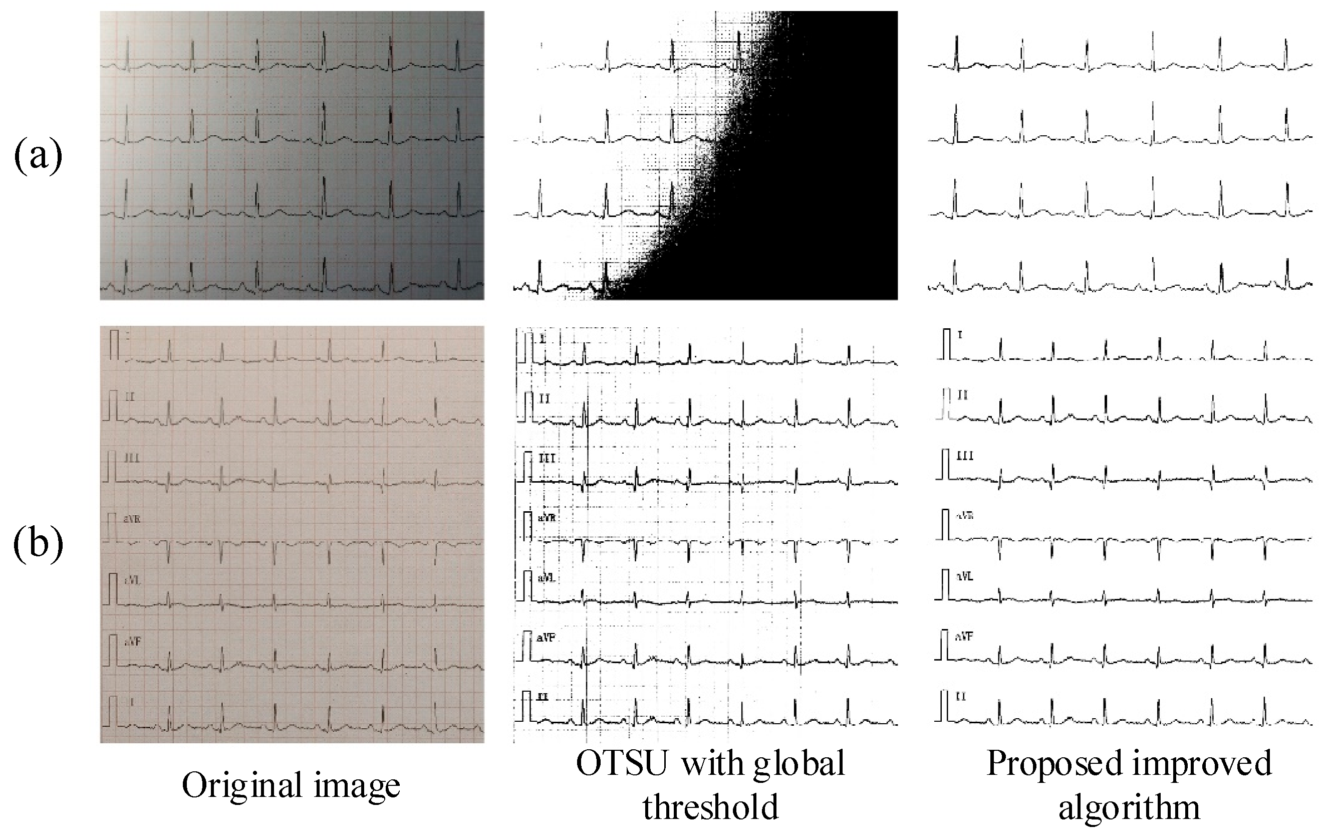 Paper-Recorded ECG Digitization Method with Automatic Reference Voltage Selection for ...