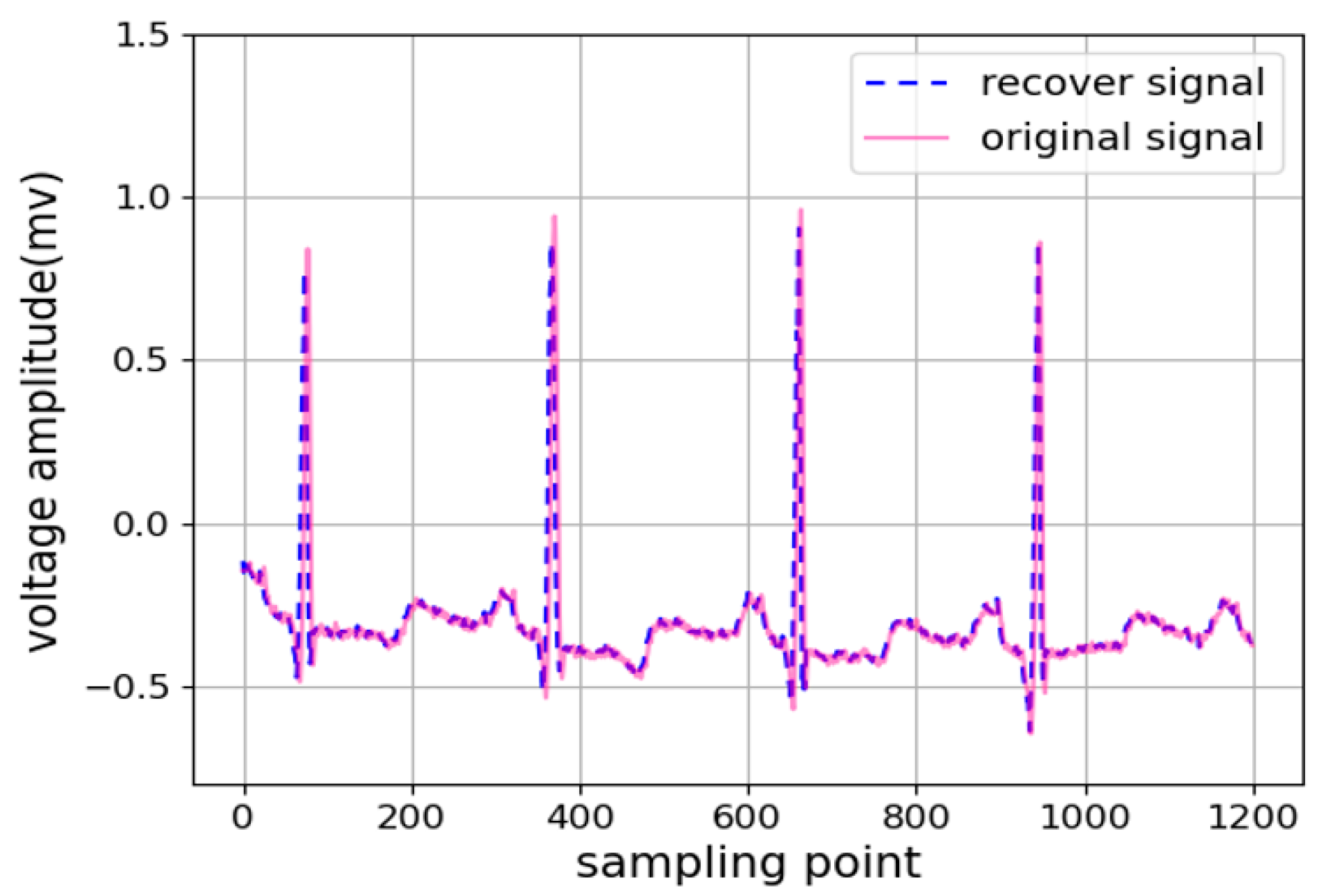 Paper-Recorded ECG Digitization Method with Automatic Reference Voltage Selection for ...