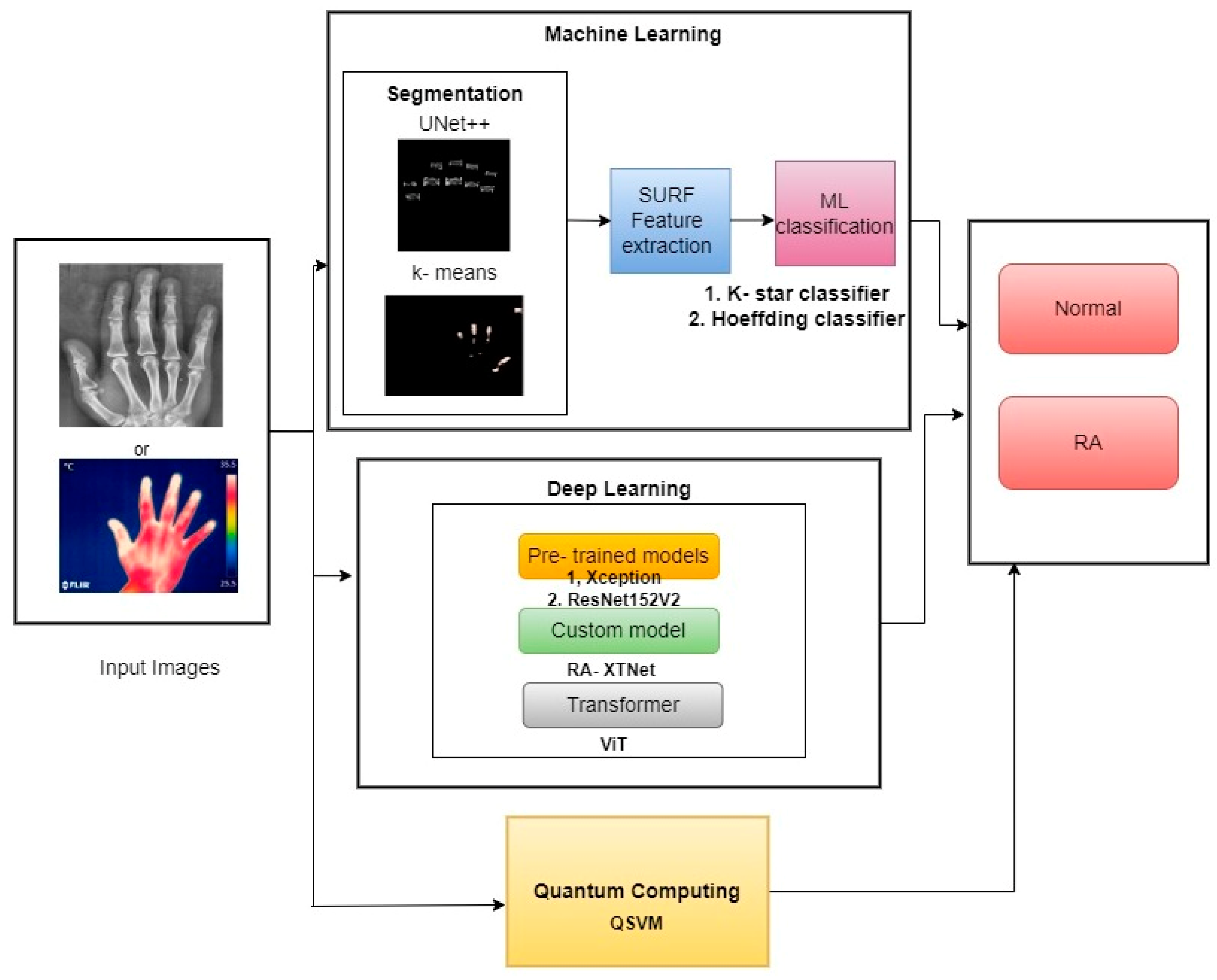 RA-XTNet: A Novel CNN Model to Predict Rheumatoid Arthritis from Hand ...