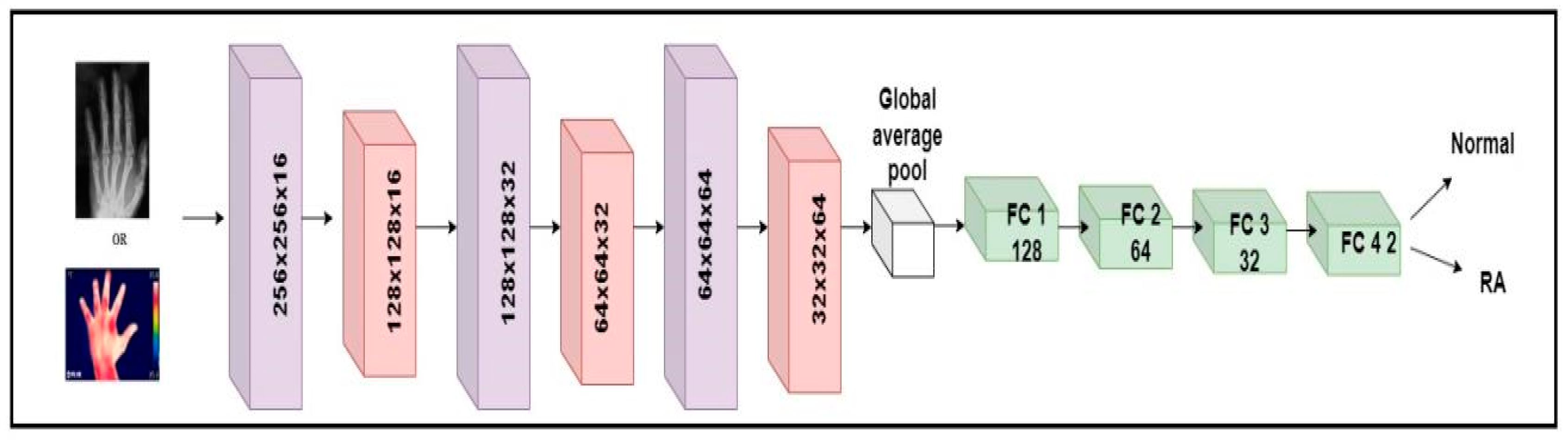 RA-XTNet: A Novel CNN Model to Predict Rheumatoid Arthritis from Hand ...