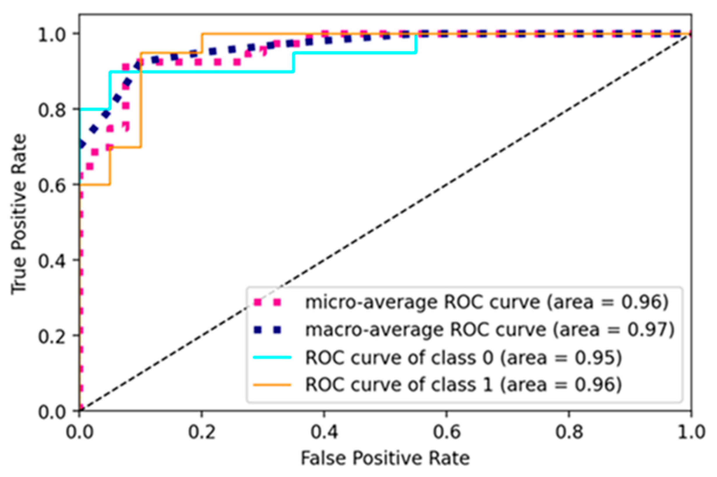 RA-XTNet: A Novel CNN Model to Predict Rheumatoid Arthritis from Hand ...