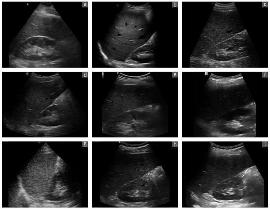 Ultrasonography Vs Ultrasound Obstetric Ultrasound Diagnostic