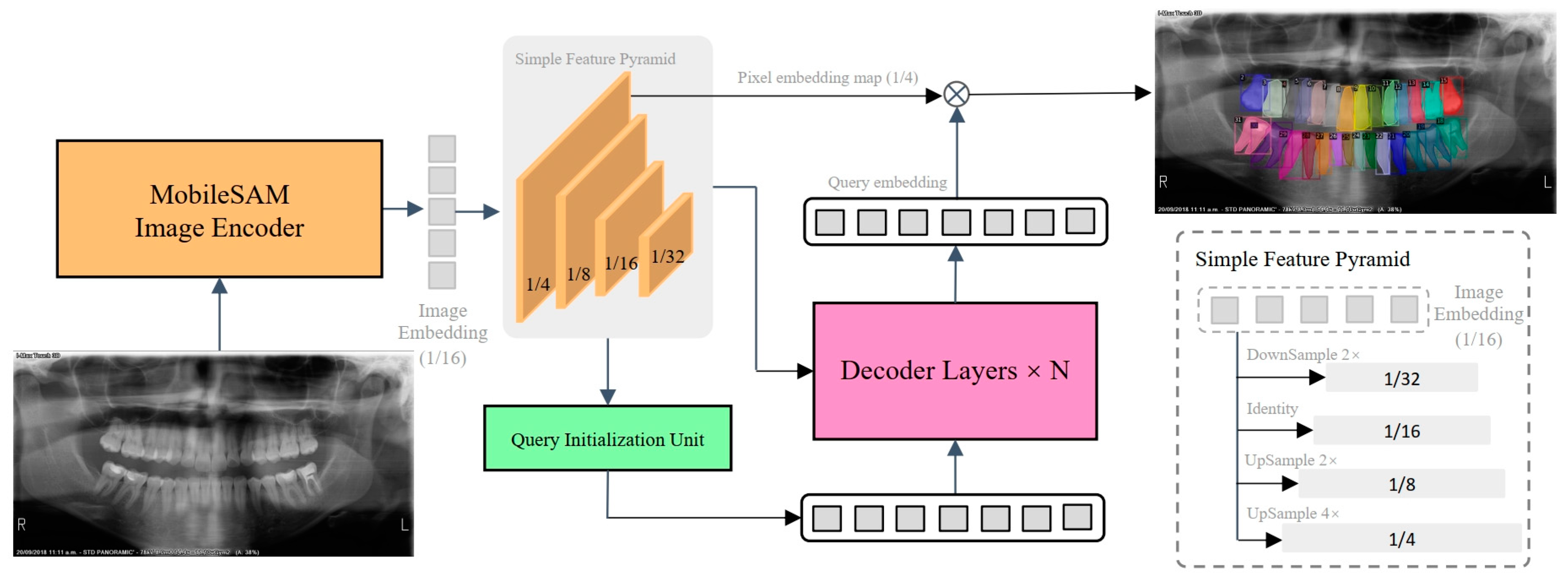 A Semi-Supervised Transformer-Based Deep Learning Framework for Automated Tooth Segmentation and ...