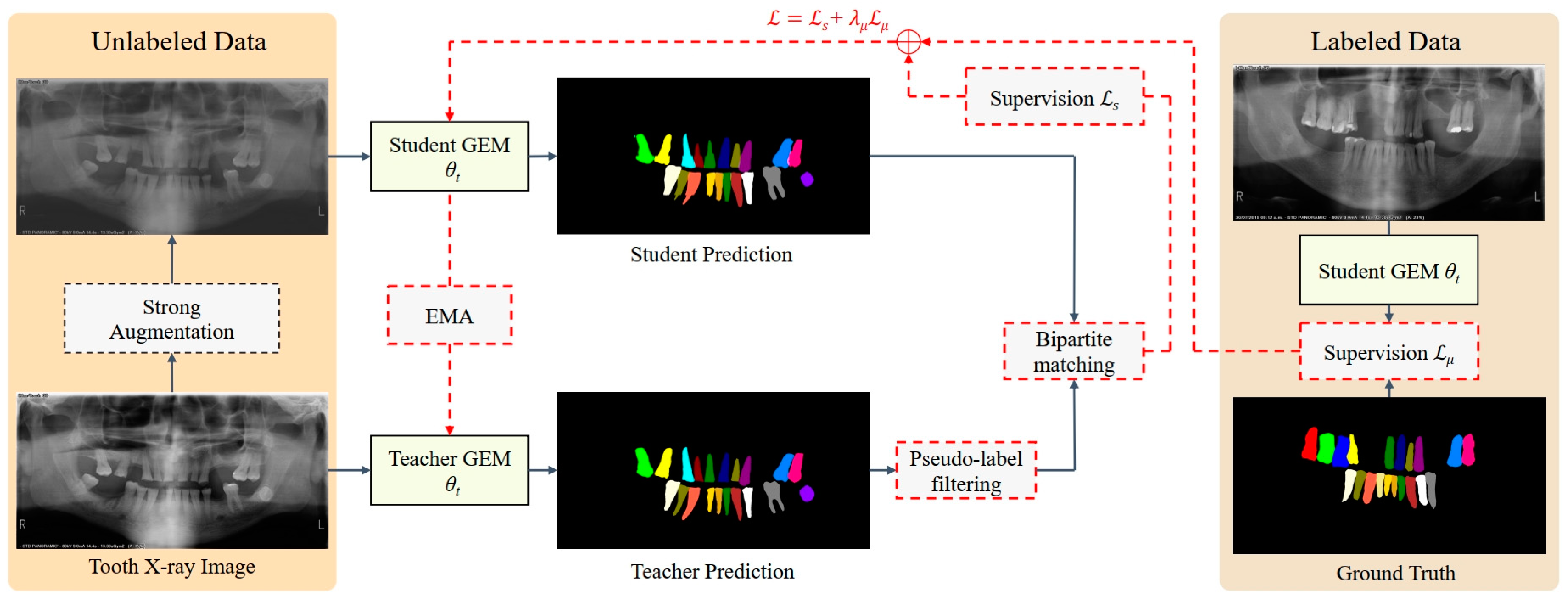A Semi-Supervised Transformer-Based Deep Learning Framework for Automated Tooth Segmentation and ...