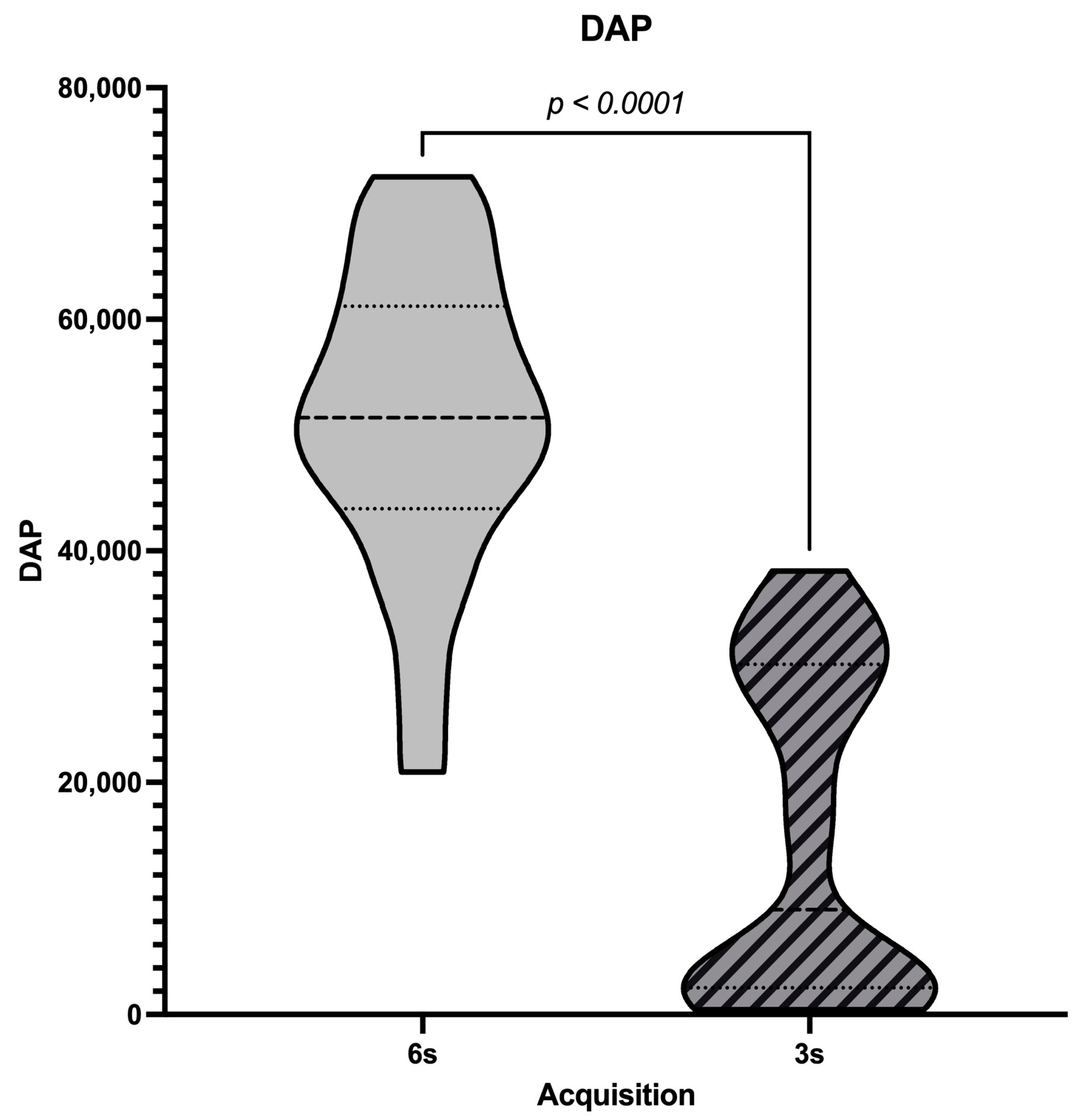 Enhancing Cone-Beam CT Image Quality in TIPSS Procedures Using AI Denoising
