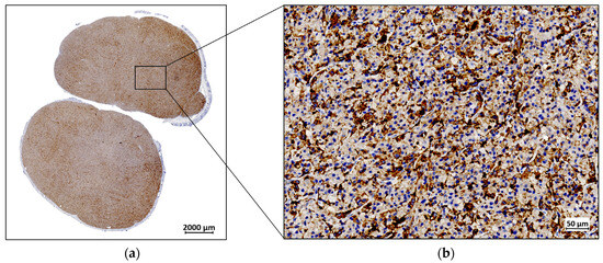 [68Ga]Ga-DOTAGA-Glu(FAPi)2 Shows Enhanced Tumor Uptake and Theranostic ...