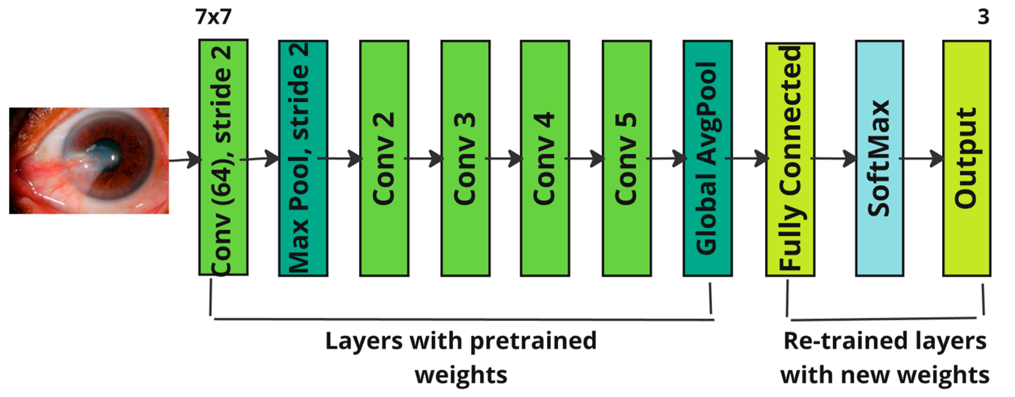 A Performance Evaluation Of Convolutional Neural Network Architectures For Pterygium Detection
