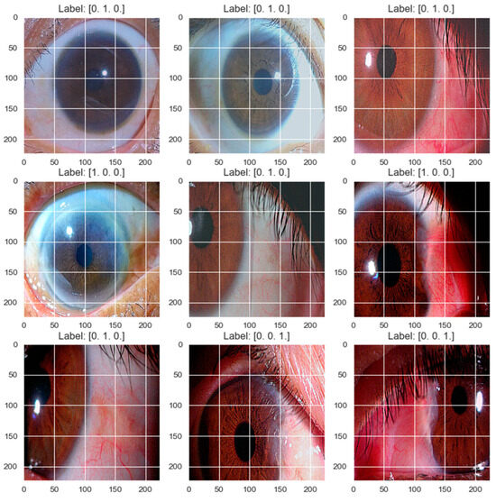 A Performance Evaluation of Convolutional Neural Network Architectures for Pterygium Detection ...