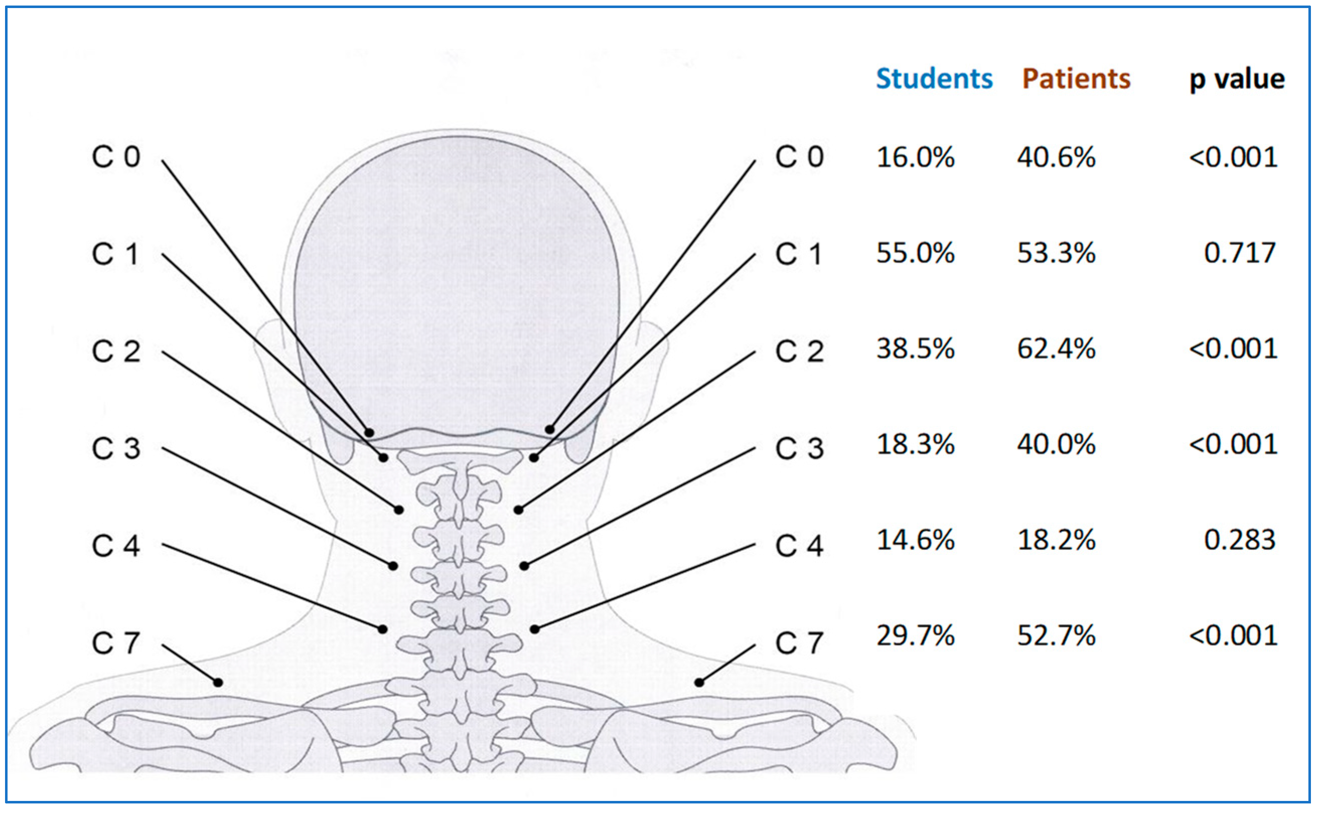 Neck Reflex Points: A New Clinical Test? Prevalence in Two Cohorts and ...