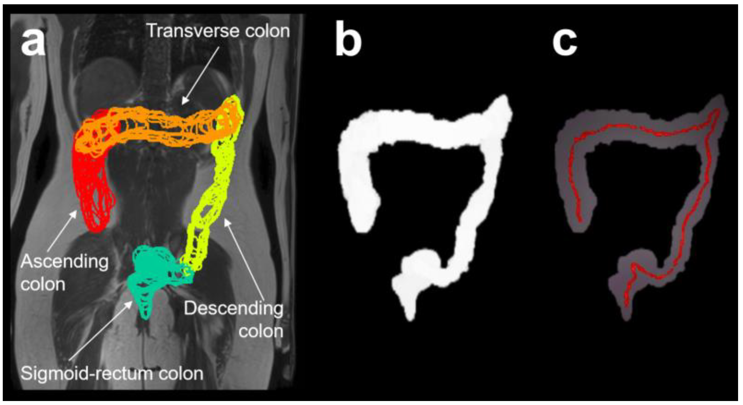 Experimental Measurements of the Length of the Human Colon: A Systematic Review and Meta-Analysis