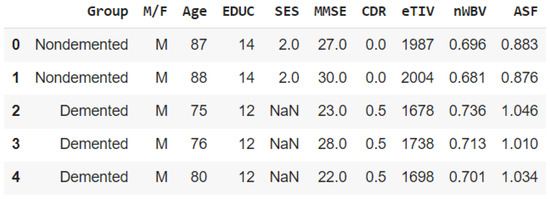 Improving Alzheimer’s Disease Prediction with Different Machine ...
