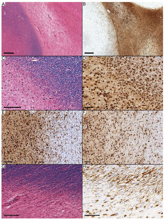 A Morphological Study of HLA-DR-Immunopositive Cells in Multiple ...