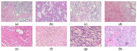 Equilibrium Optimization-Based Ensemble CNN Framework for Breast Cancer Multiclass ...