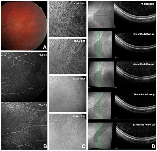 Longitudinal Structural and Functional Evaluation of Dark-without ...