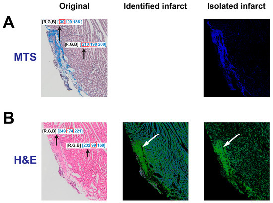 Detection, Isolation and Quantification of Myocardial Infarct with Four ...