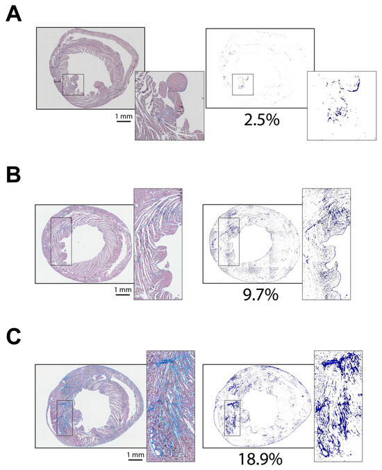 Detection, Isolation and Quantification of Myocardial Infarct with Four ...