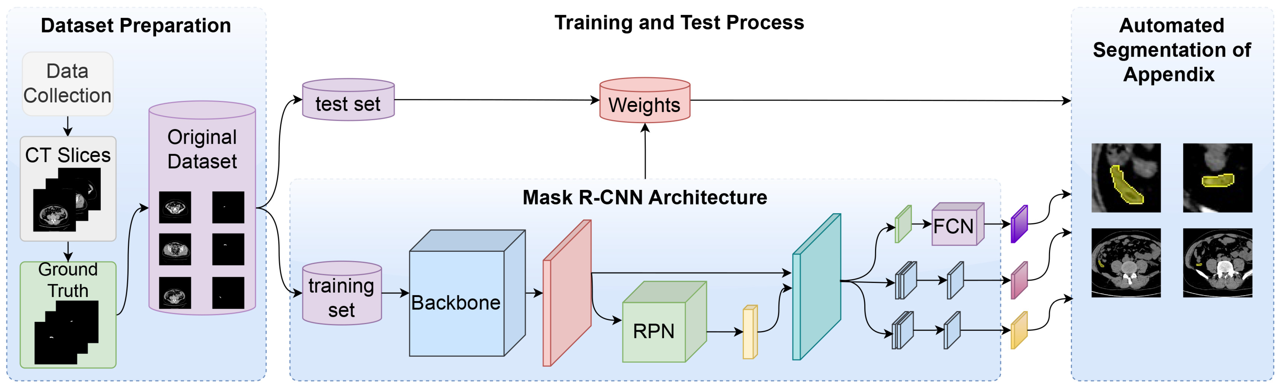 MaskAppendix: Backbone-Enriched Mask R-CNN Based on Grad-CAM for Automatic Appendix Segmentation