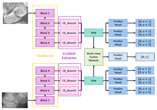 The Detection and Classification of Scaphoid Fractures in Radiograph by Using a Convolutional ...