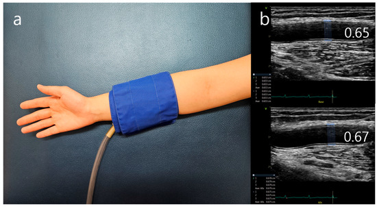A Comprehensive Review of Clinical Studies Applying Flow-Mediated Dilation
