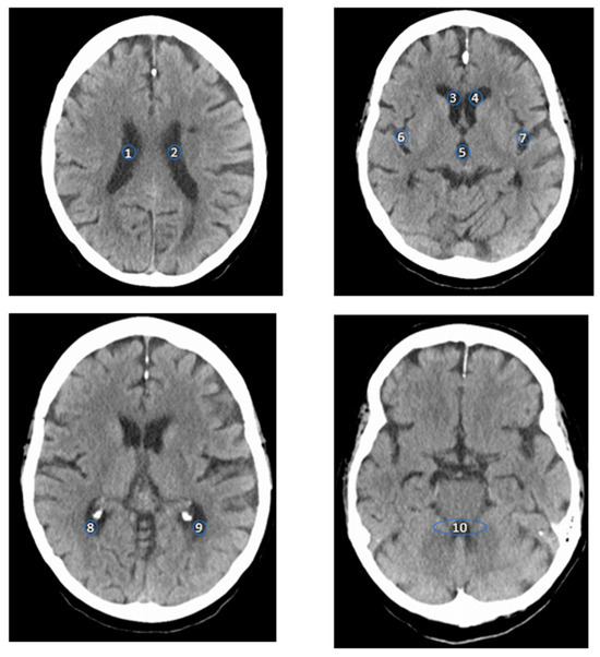 Creating a Foundation for the Visualization of Intracranial ...