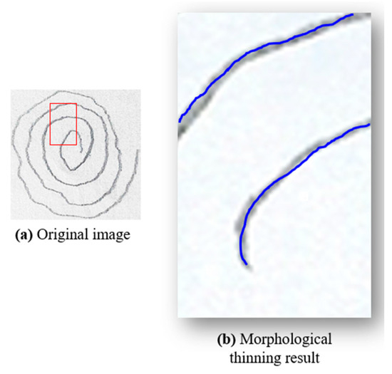 Early Detection of Parkinson’s Disease Using AI Techniques and Image ...