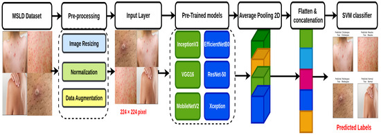 TMS: Ensemble Deep Learning Model for Accurate Classification of Monkeypox Lesions Based on ...
