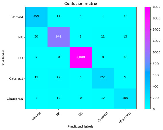 CAD-EYE: An Automated System for Multi-Eye Disease Classification Using ...