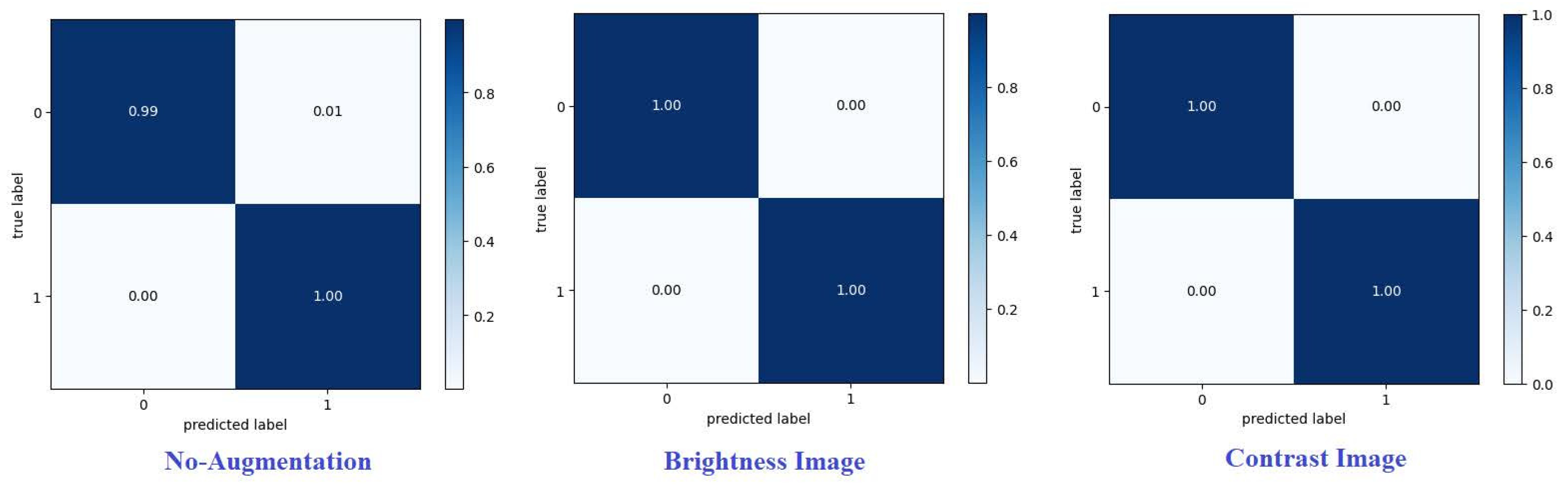 A Hybrid Deep Learning Model with Data Augmentation to Improve Tumor Classification Using MRI Images