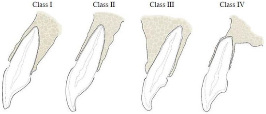Analysis of the Sagittal Root Position of the Maxillary and Mandibular ...