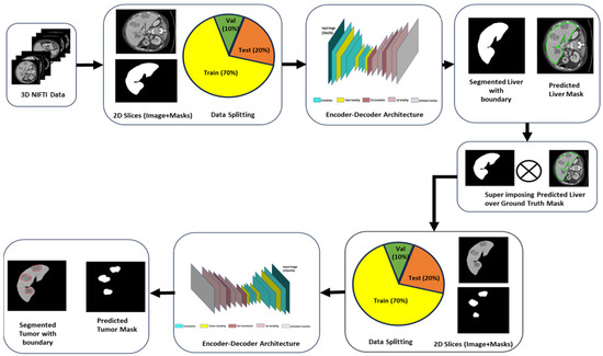 A Comparative Study of Decoders for Liver and Tumor Segmentation Using a Self-ONN-Based Cascaded ...