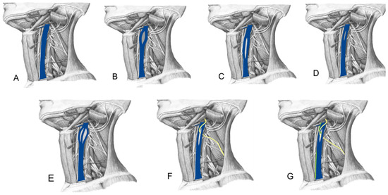 Systematic Review and Meta-Analysis of Internal Jugular Vein Variants ...