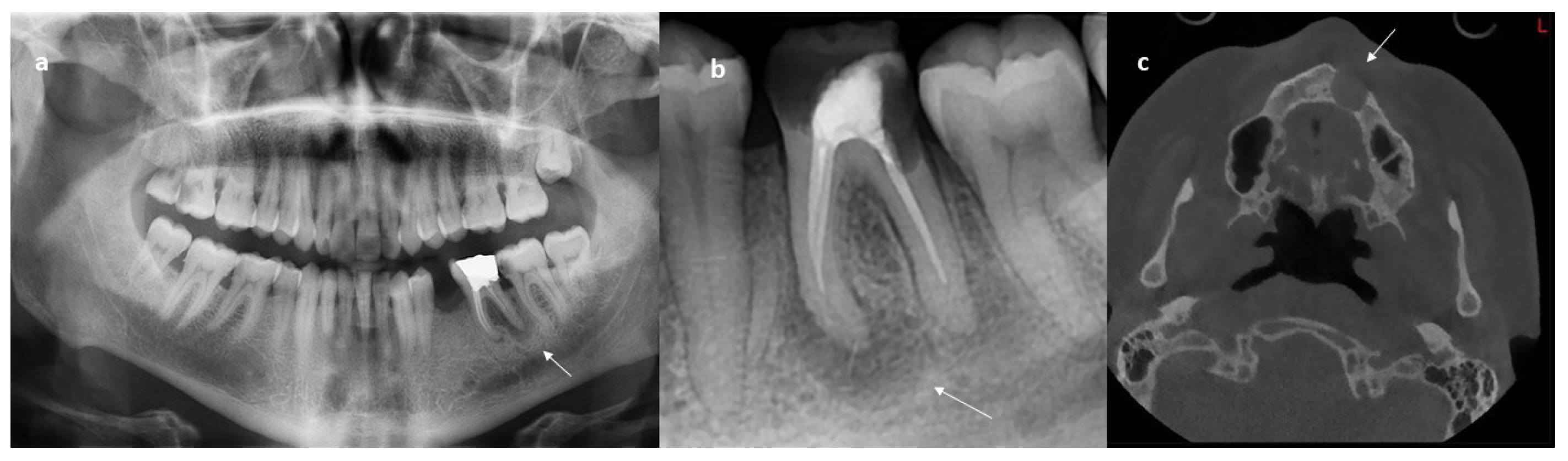 Comprehensive Insights into Artificial Intelligence for Dental Lesion ...